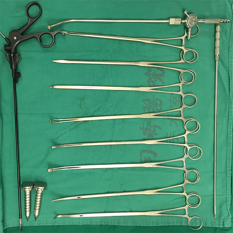 Mckeown Procedure : Modified McKeown procedure with uniportal thoracoscope for ... : Wang q ...