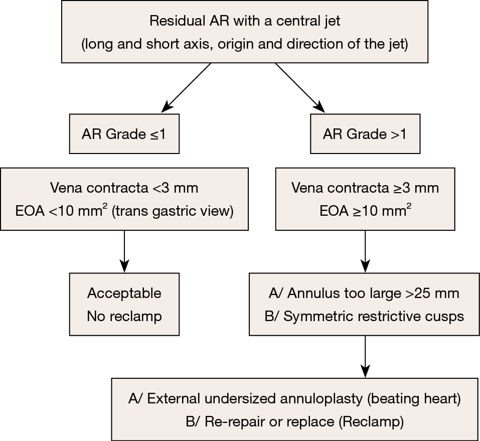 Systematic echocardiographic assessment of aortic regurgitation—what ...
