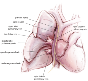 right upper lobectomy technique