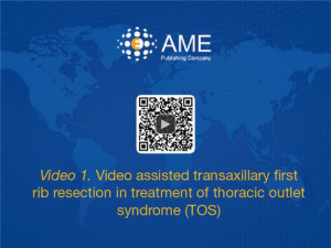Video assisted transaxillary first rib resection in treatment of ...