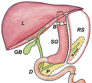 Endoscopy in surgically altered anatomy - Morrell - Annals of ...
