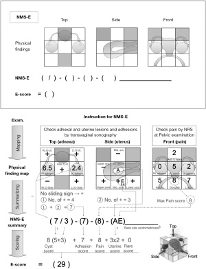 Preoperative classification of endometriosis: a narrative review of ...