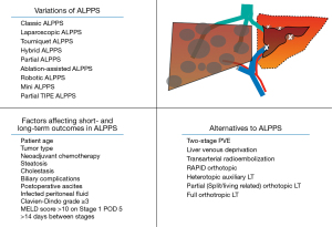 The ALPPS procedure—As Limited Procedures as Possible, leads to ...