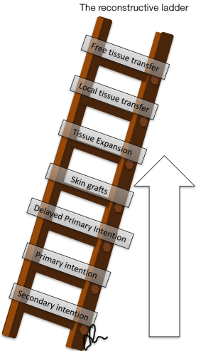reconstructive process example