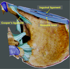 Myopectineal Orifice