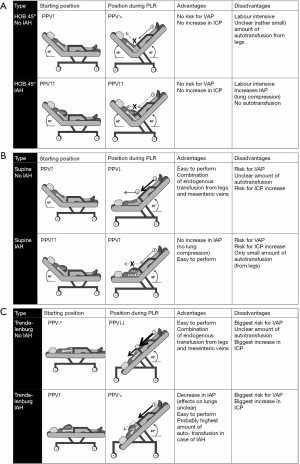 Predicting fluid responsiveness with the passive leg raising test: don ...