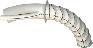 Implantation of frozen elephant trunk (FET)—surgical technique ...