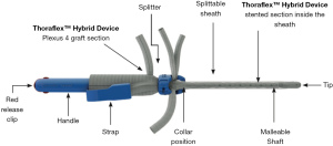 Implantation of frozen elephant trunk (FET)—surgical technique ...