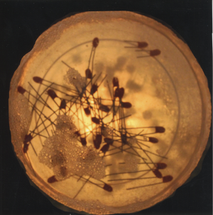 Networked Life - Gribble - Cardiovascular Diagnosis and Therapy