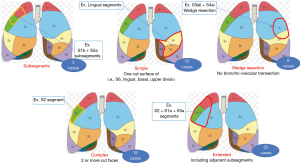The new technology of precise anatomical sublobar resection by using 3D ...