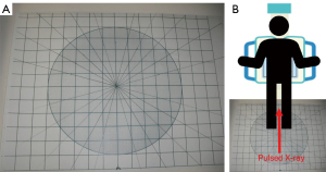 Clinical utility of dynamic chest radiography in the oblique view to ...