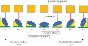 Clinical utility of dynamic chest radiography in the oblique view to ...