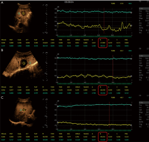 Kupffer phase echo level ratio in contrast-enhanced ultrasound for ...