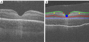 Validating DevCheck: a semi-automated computer algorithm for measuring ...