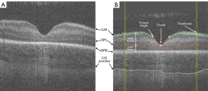 Validating DevCheck: a semi-automated computer algorithm for measuring ...