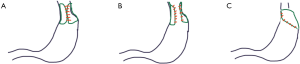 Comparison between robotic Nissen, Toupet and Dor fundoplication ...