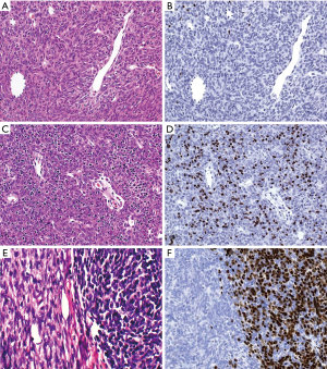 thymus starry sky pattern