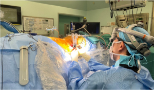 Single position, prone oblique lateral interbody fusion (OLIF)—case ...