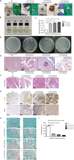 Antibacterial molybdenum disulfide with silver phosphate coating on ...