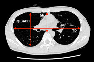 Thoracic morphological characteristics of primary spontaneous ...