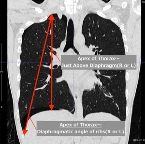 Thoracic morphological characteristics of primary spontaneous ...