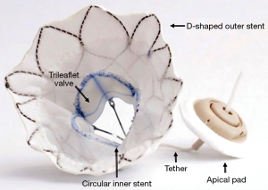 Transcatheter mitral valve replacement: an evolution of a revolution ...