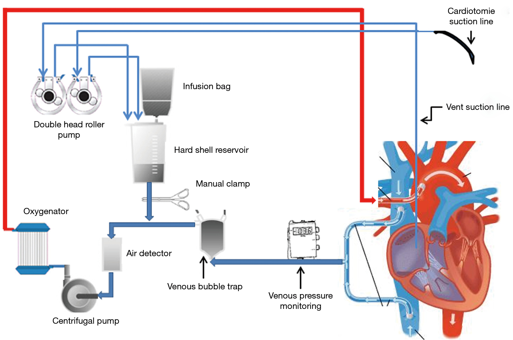 Heart Endoscopy Procedure
