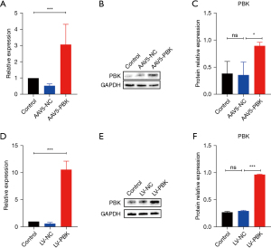 The role and mechanism of PDZ binding kinase in hypobaric and hypoxic ...