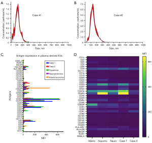 Liquid biopsy perspectives in pleomorphic carcinoma of the lung: case ...