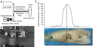 A narrative review of imaging tools for imaging subgingival calculus ...