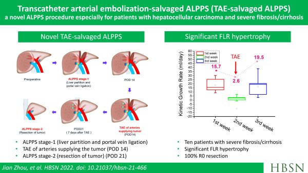 Home - Hepatobiliary Surgery and Nutrition